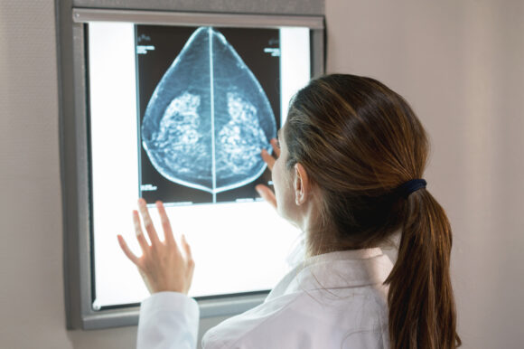 Mammography Technologist (Mammographer) – Augusta Health